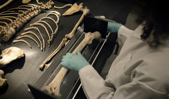 Malaysia’s shortage of forensic anthropologists a growing concern, says ...