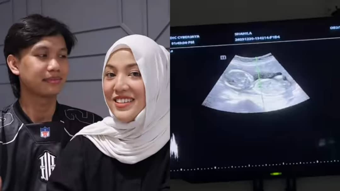 Kejutan 2024, Shila Amzah hamil anak pertamanya bersama Ubai | Scoop