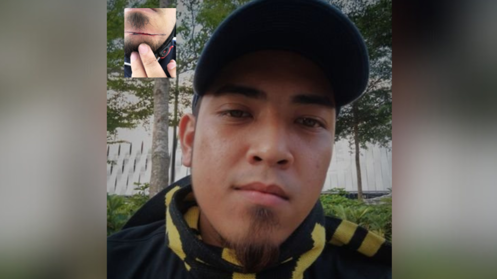 Pemuda koyak dagu, gara-gara terlanggar benang dipasang di laluan ...