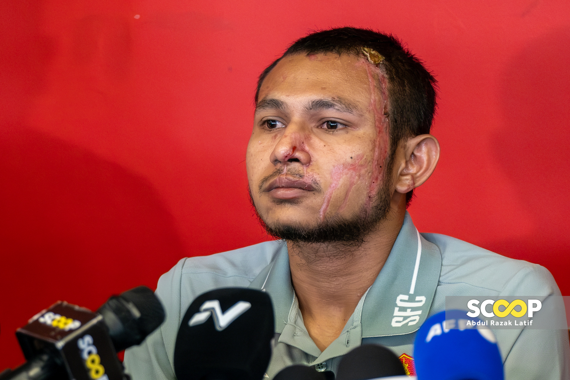 Selangor FC demand answers from cops on Faisal Halim’s acid attack | Scoop